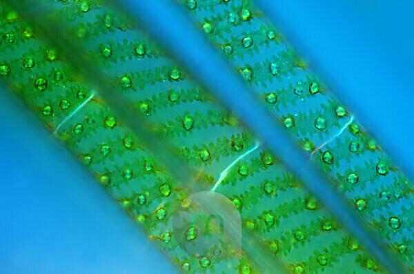 Spirogyra 400x Magnification