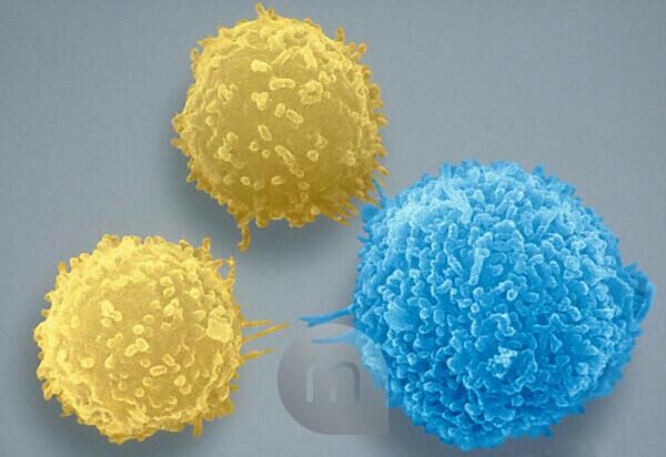 lymphocytes under electron microscope